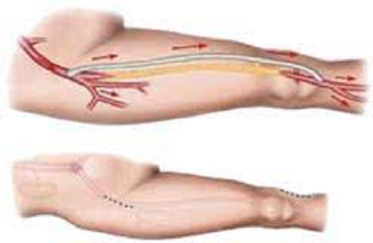 Portfolio - Chirurgien vasculaire - Dr Hamid CHANNANE